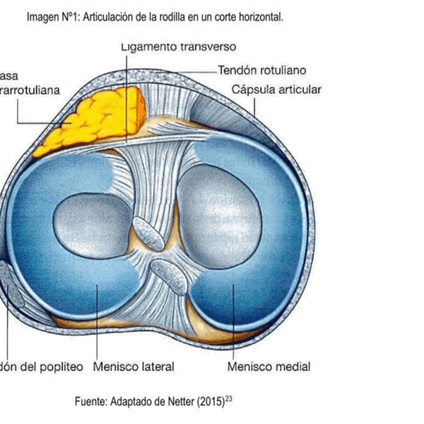 Patrones de edema óseo traumático en la rodilla y su correlación con ...